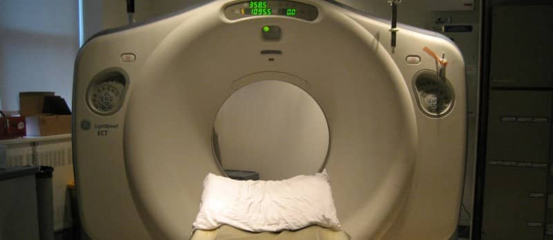 The Effects of Radiation from CT Scans