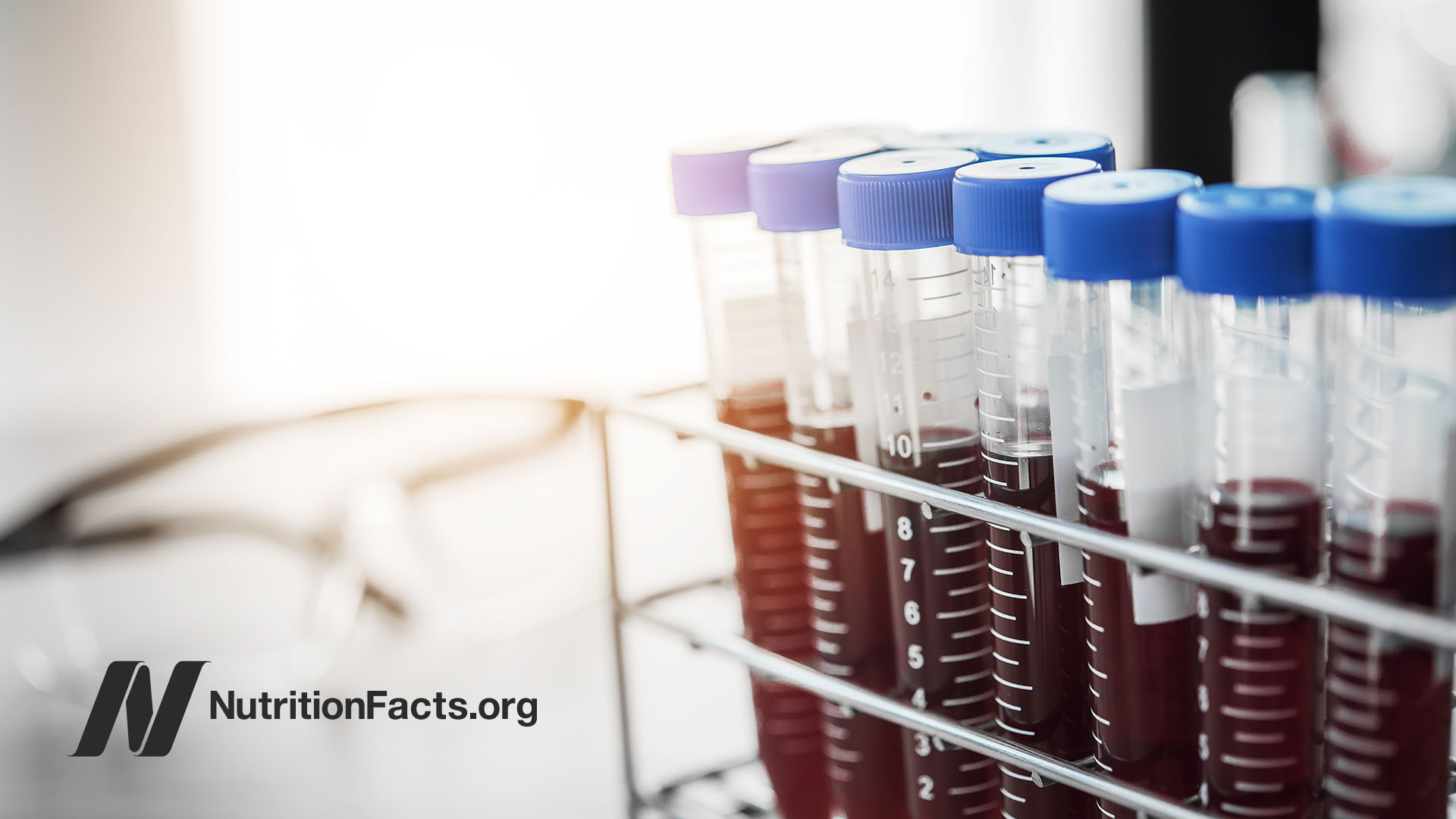 Heme Iron: The Latest Research | NutritionFacts.org