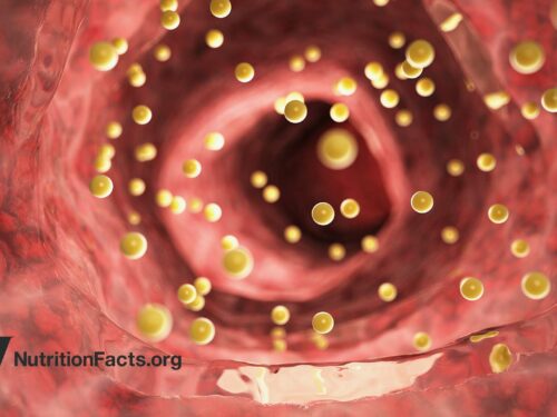 LDL cholesterol | Health Topics | NutritionFacts.org