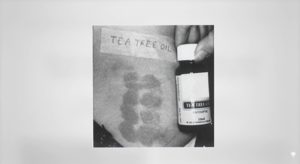 Safety Concerns with Tea Tree Oil?