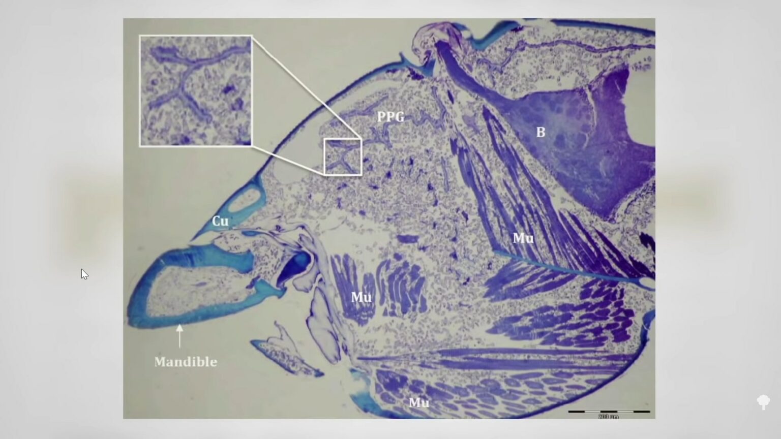 Toxoplasmosis Infection from a Brain Parasite