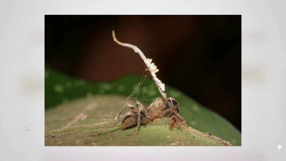 Toxoplasmosis Infection from a Brain Parasite
