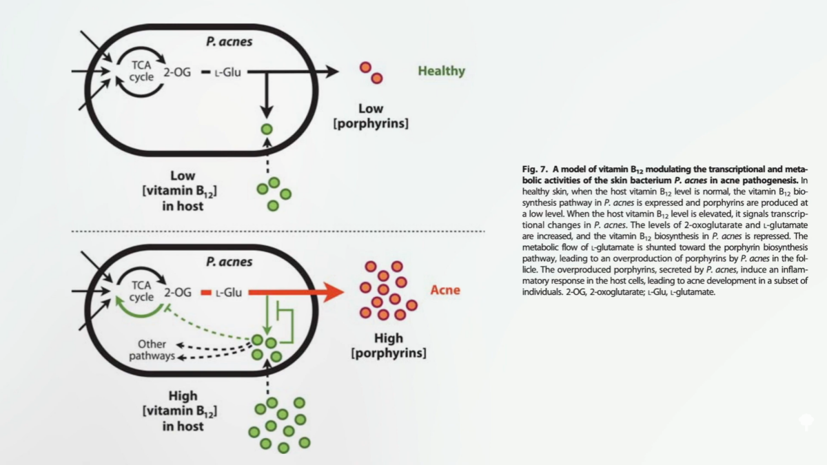 Acne and Vitamin B12