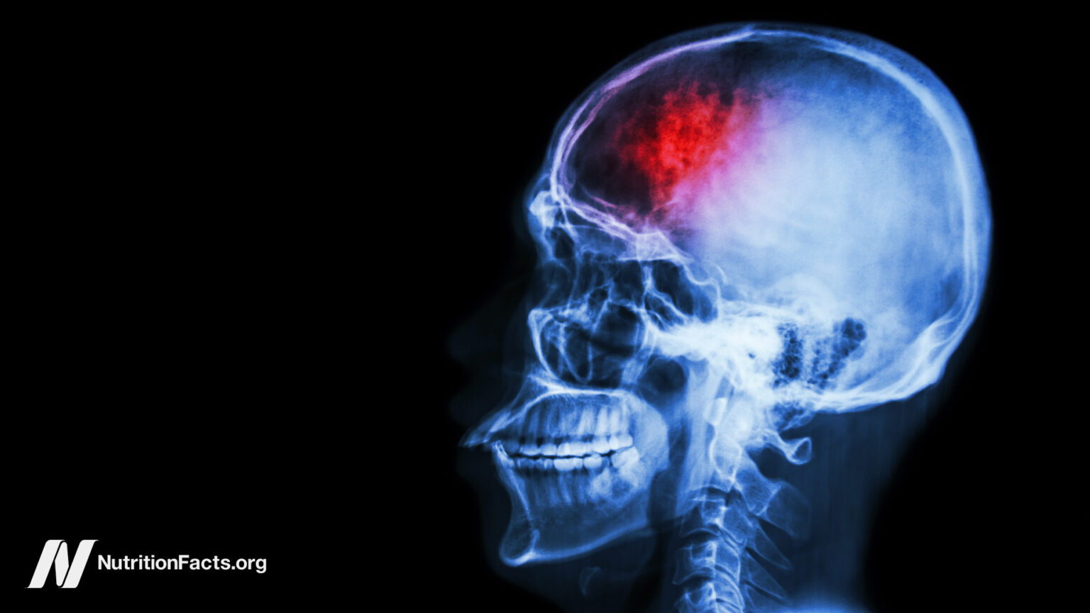 Fasting and Plant-Based Diets for Migraines and Traumatic Brain Injuries